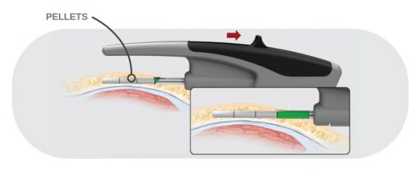 Hormone Balancing Supplement | Hormone Treatment | Re3®